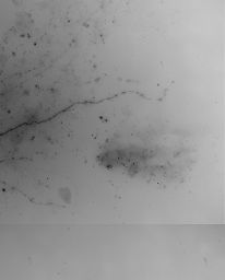 Morphology Experiment :: Allen Brain Atlas: Cell Types